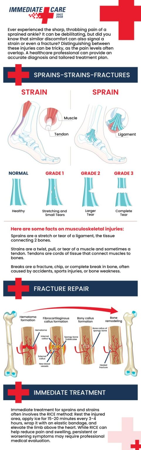 How Is a Simple Fracture Treated? | Immediate Care of Oklahoma